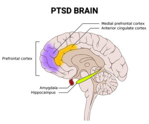 PTSD & Complex PTSD Therapy in New York, NY